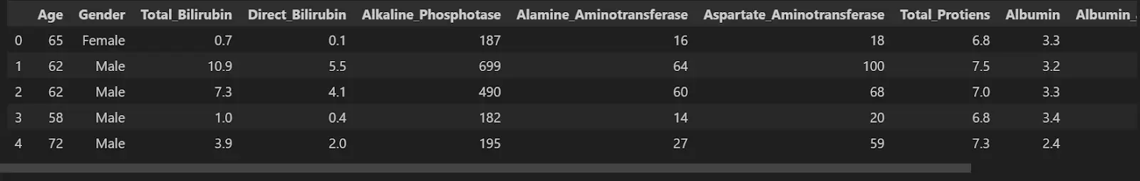 Liver Disease Prediction Using Machine Learning